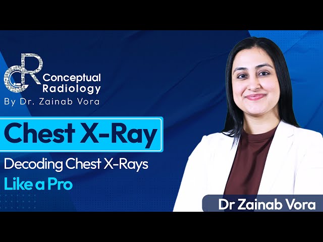 Mastering Chest X-Ray Interpretation: A Comprehensive Guide with Dr ...