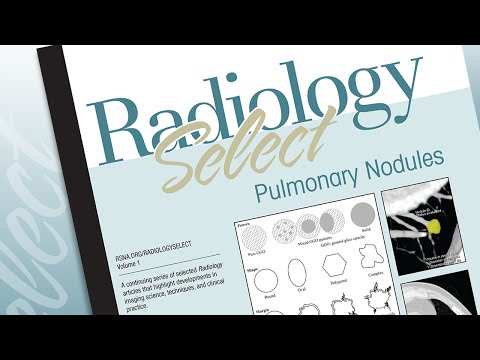 Radiology Select Volume 1: Pulmonary Nodules