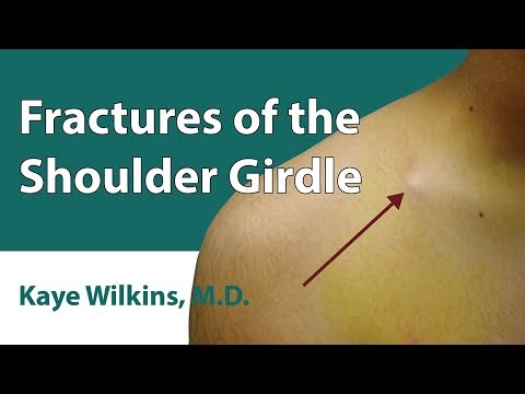 Fractures Of The Shoulder Girdle
