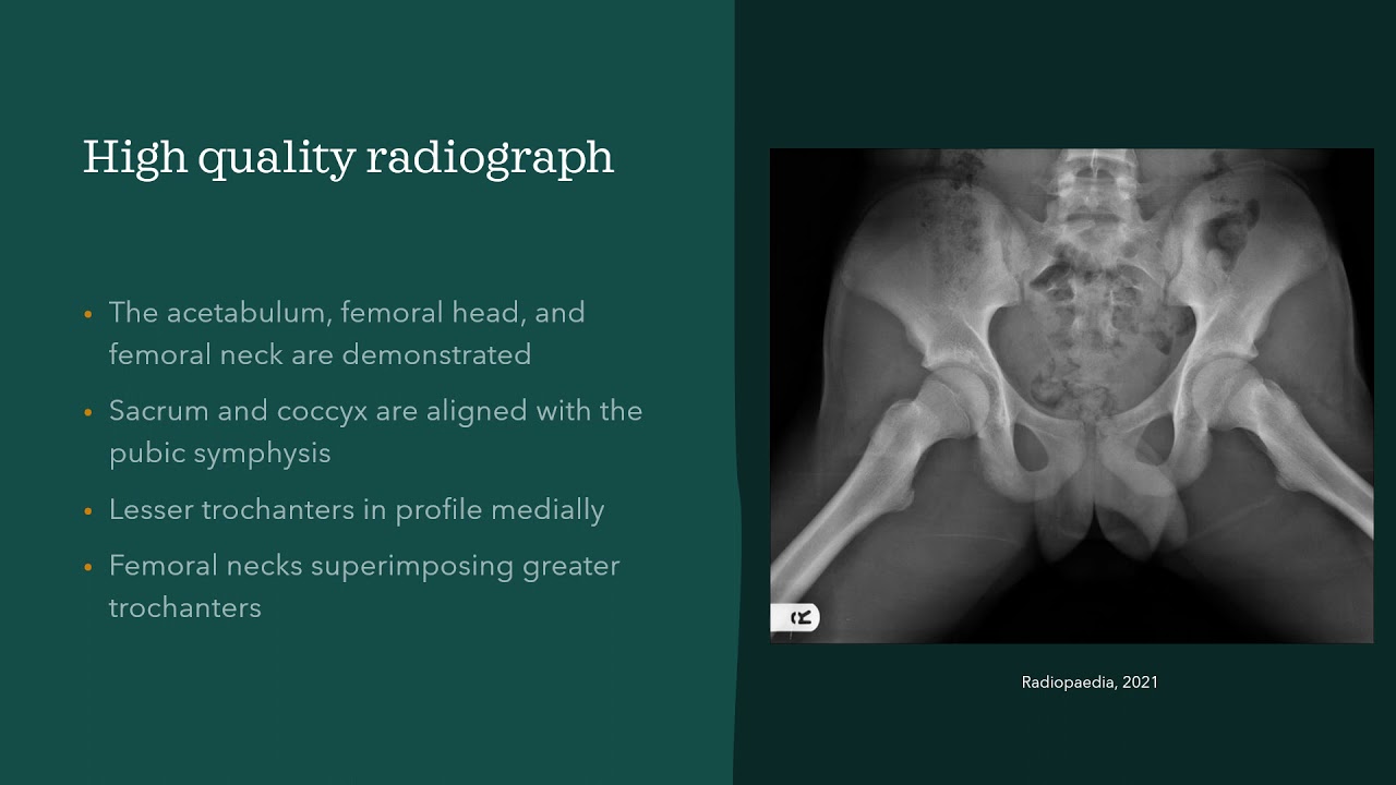 Image analysis powerpoint