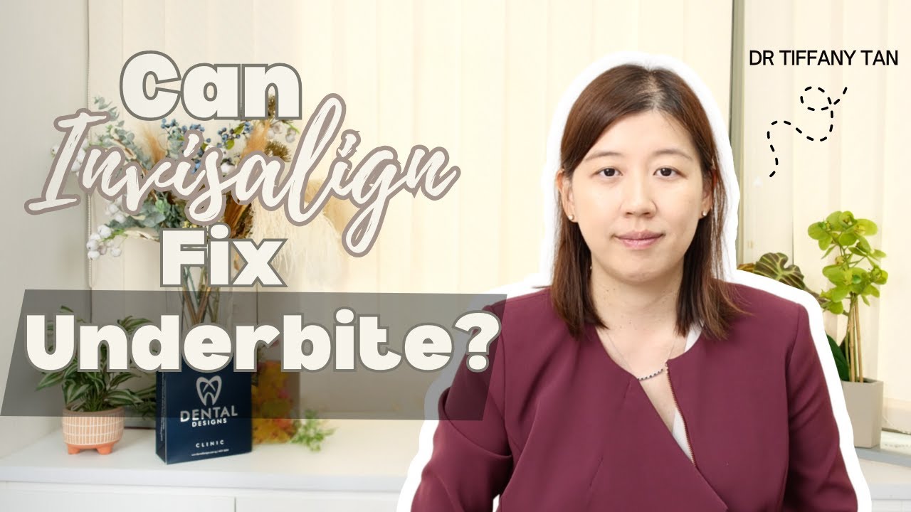 Underbite and Invisalign — Can Invisalign Fix Underbite?
