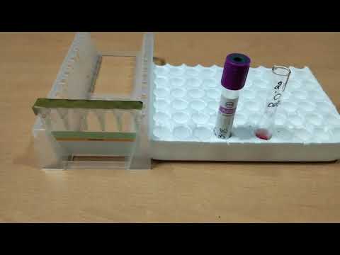 Indirect Coombs test by CAT method