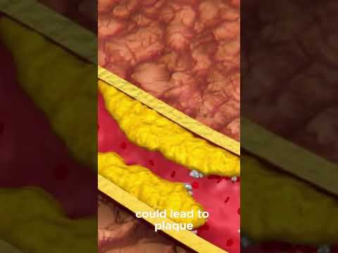 Good vs  Bad #cholesterol   What's the Difference #healthyliving #lipidprofile #HDL #LDL #VLDL