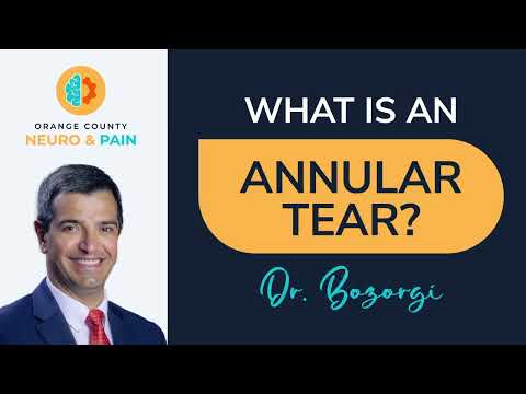 What is an Annular Tear? by Dr. Alireza Bozorgi - OC Neuro & Pain Institute