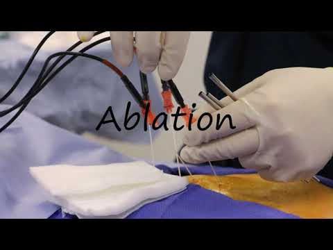 How to Pronounce Ablation?