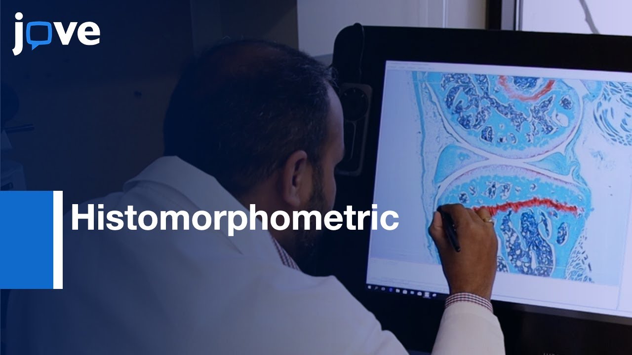Histomorphometric: Evaluation of Osteoarthritis | Protocol Preview