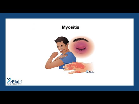 Myositis