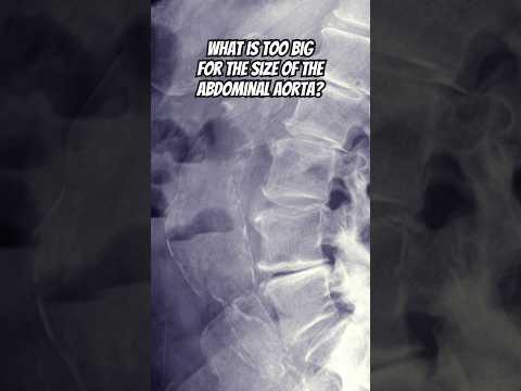 🤔HOW BIG is TOO BIG🤔for the Abdominal Aorta? 📏#radiology #chiropractic #doctor