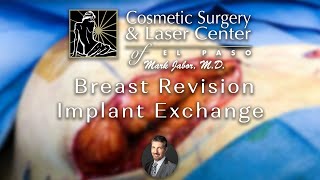 Plastic Surgery Videos | El Paso, Texas