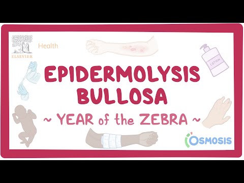 Epidermolysis Bullosa (Year of the Zebra)