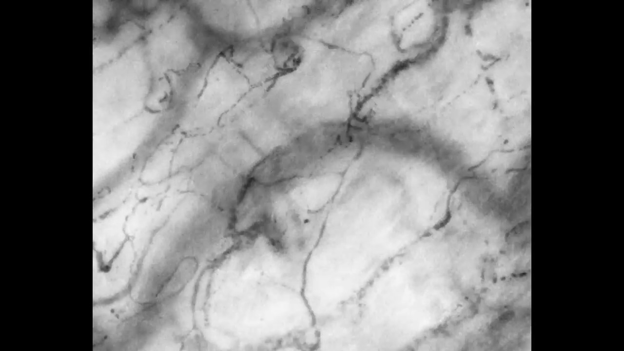 Altered microcirculation