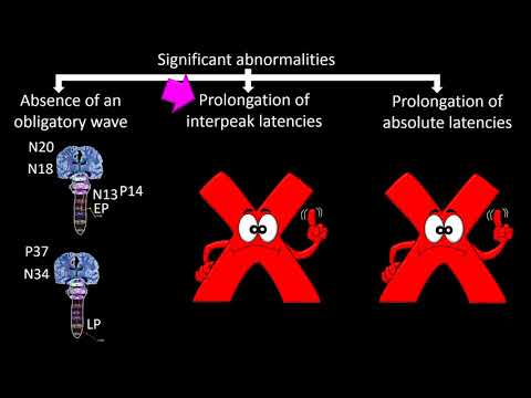 How to read SSEP