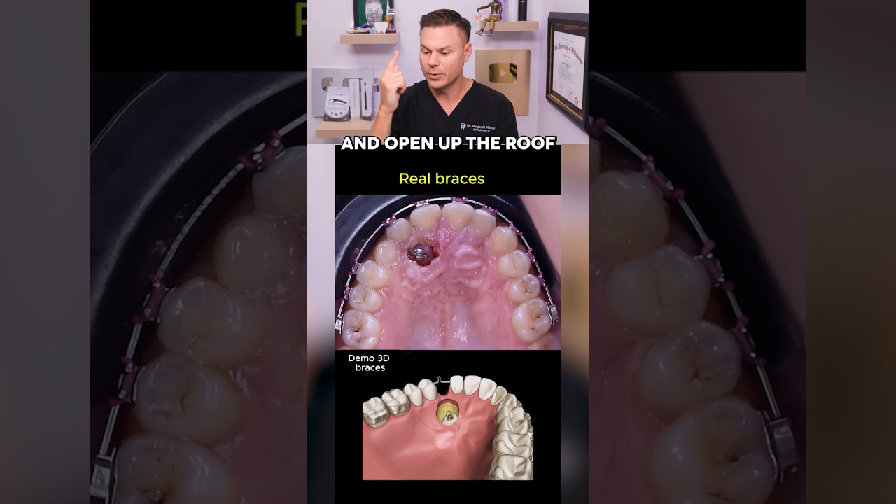 This Braces Transformation Will SHOCK You! 😭🦷