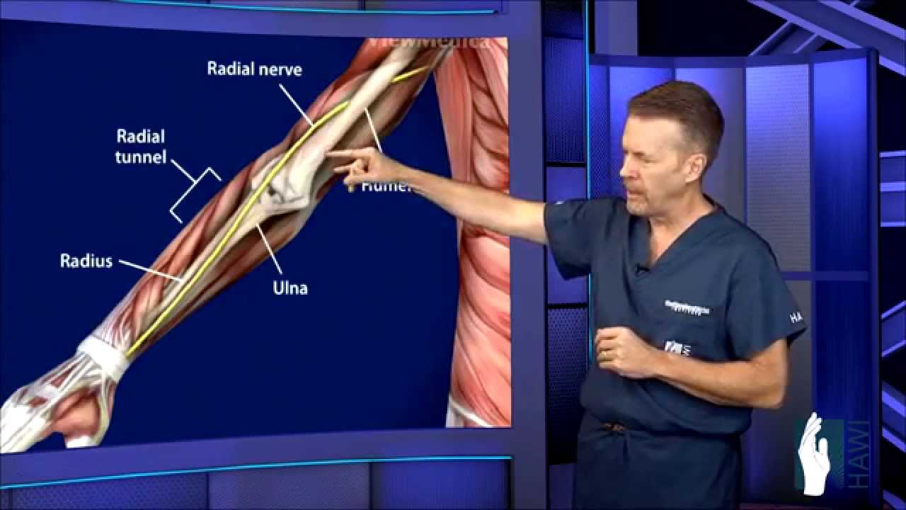 Radial Tunnel Surgery