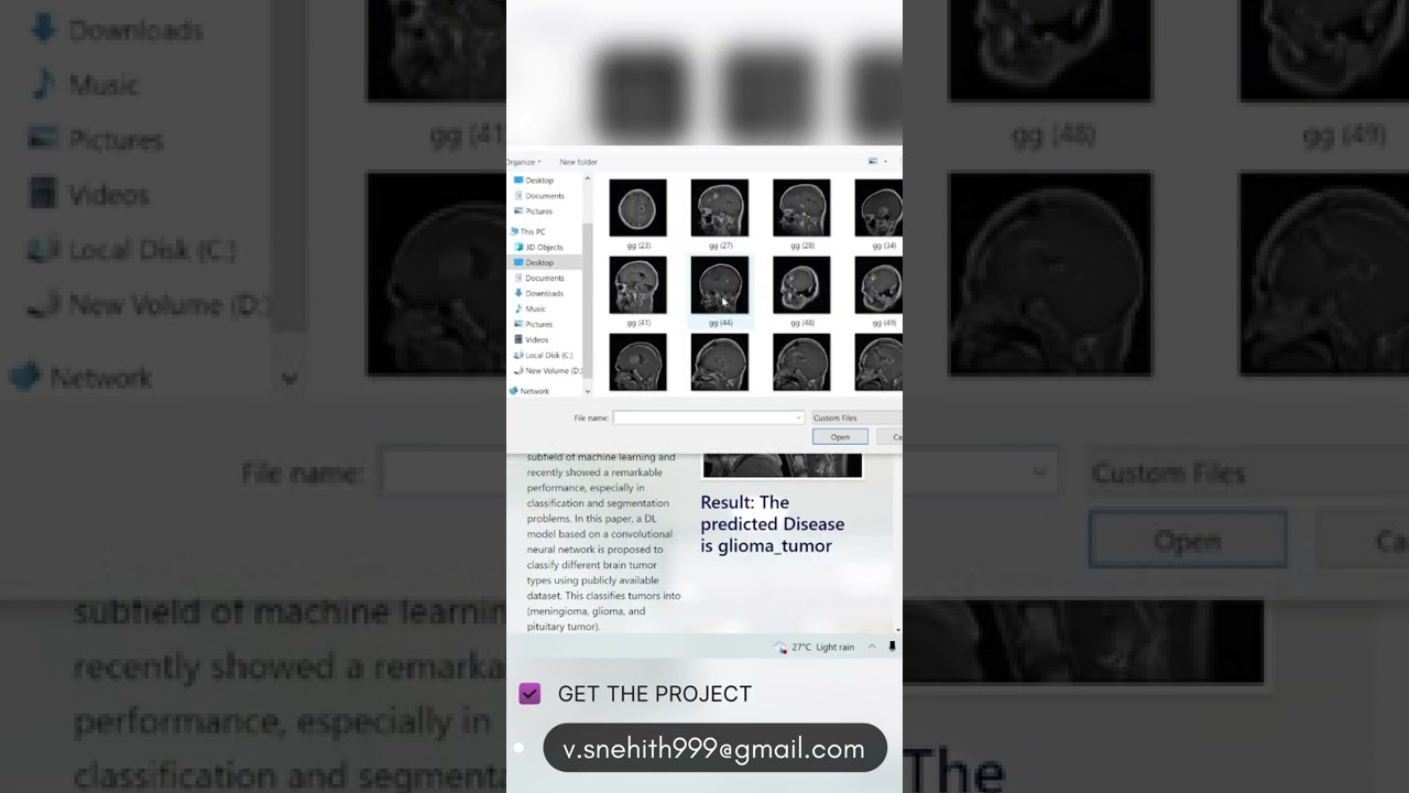 Project for Sale : BRAIN TUMOR CLASSIFICATION #btech #project #python
