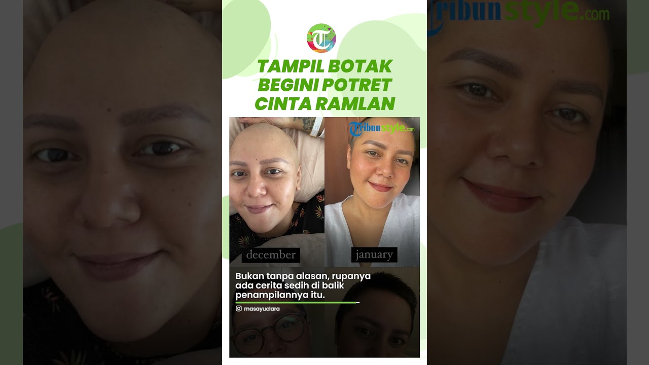 Tampil Botak, Artis Cinta Ramlan Divonis Sakit Kanker, Curhat Perubahan ...