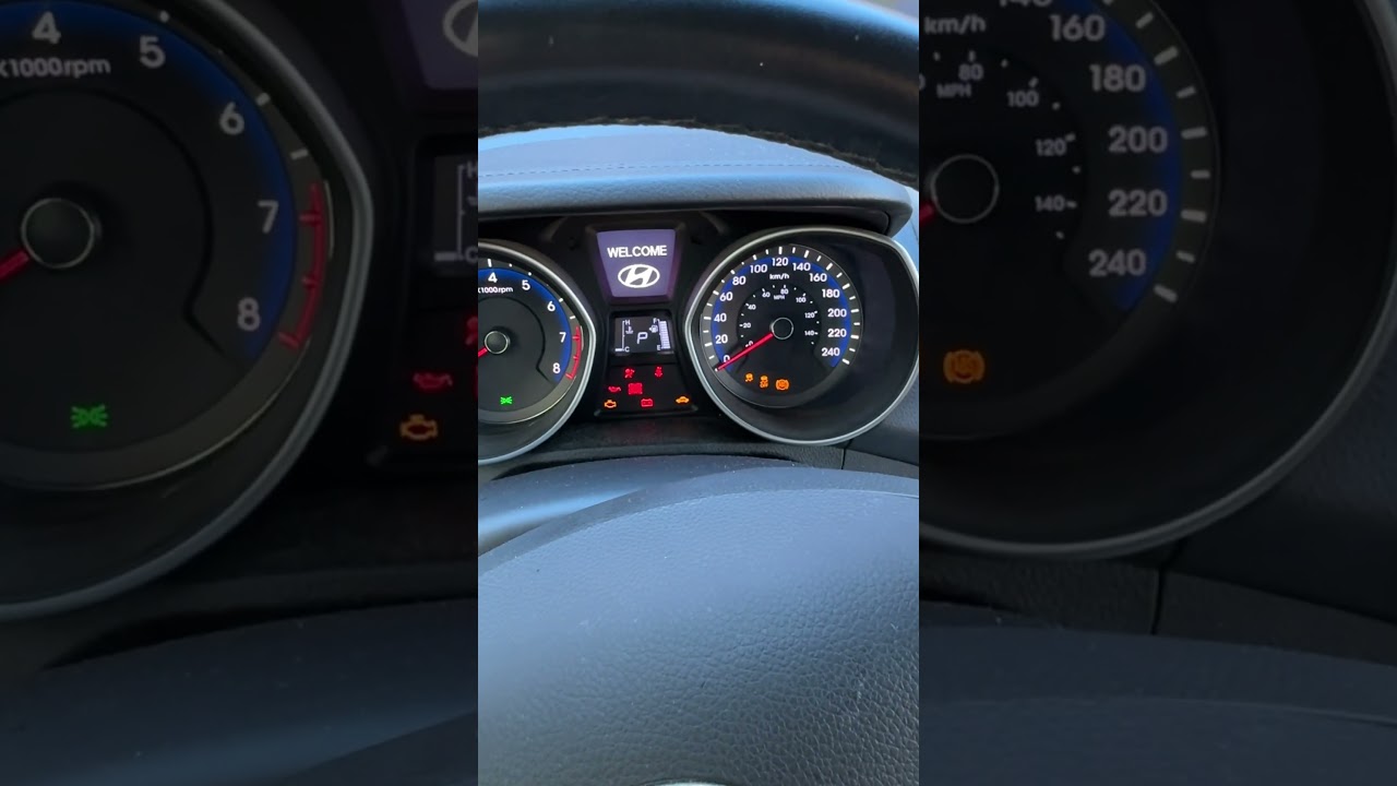 Hyundai Elantra GT 2016 cannot start, lights clicking , what is the problem please? #hyundaiglovis