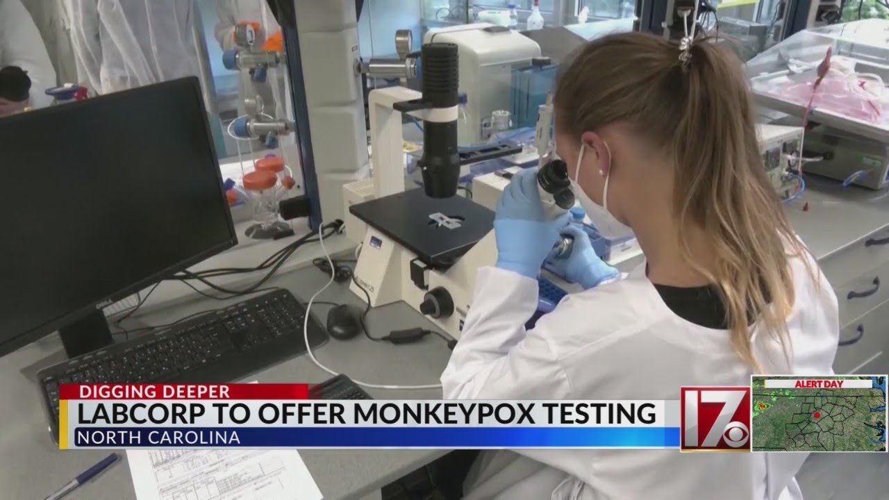 LabCorp to offer monkeypox testing