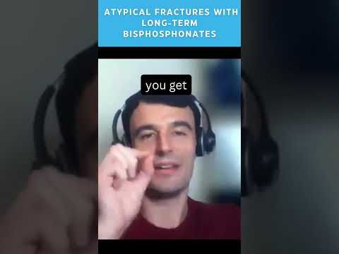 Atypical Fractures with Long-Term Bisphosphonates