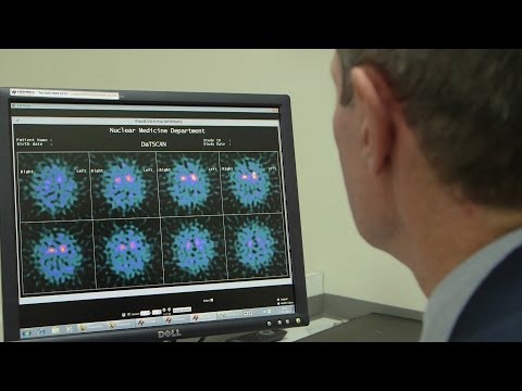 Tackling dementia - Newcastle University