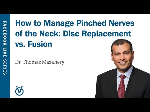 How to Manage Pinched Nerves of the Neck: Disc Replacement vs. Fusion