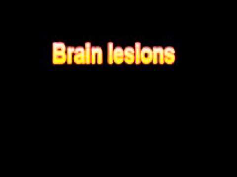What Is The Definition Of Brain lesions Medical Dictionary Free Online