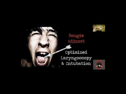 What You Don't Know About Bougies