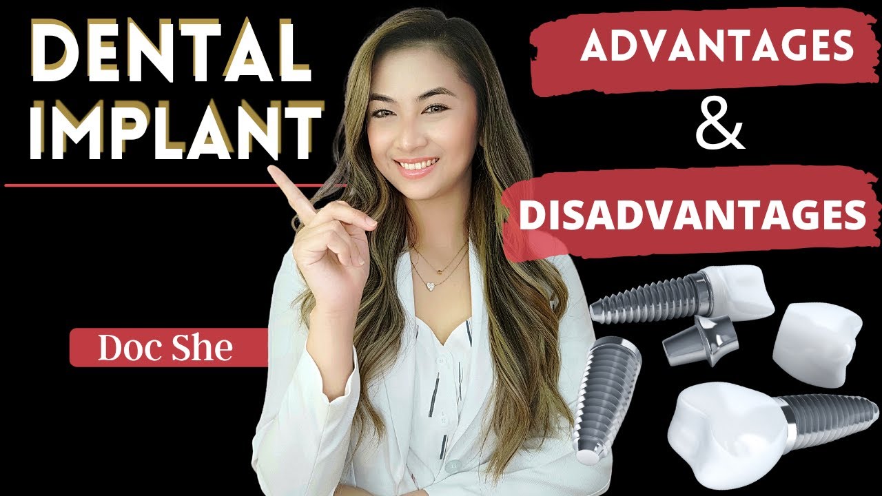 DENTAL IMPLANTS ADVANTAGES AND DISADVANTAGES / PROS AND CONS of DENTAL IMPLANTS