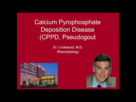 10 Calcium Pyrophosphate Deposition Disease (Pseudogout)