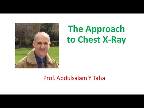 The Approach to Chest X Ray