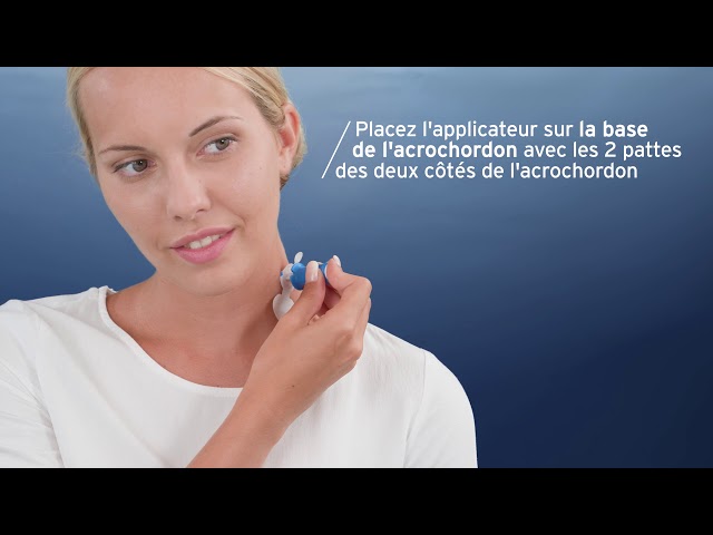 Excilor® Traitement des Acrochordons 3 pc(s) - farmaline.be