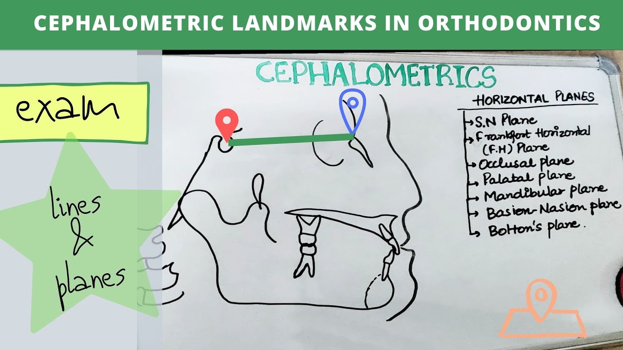 cephalometrics in orthodontics - orthodontics lecture