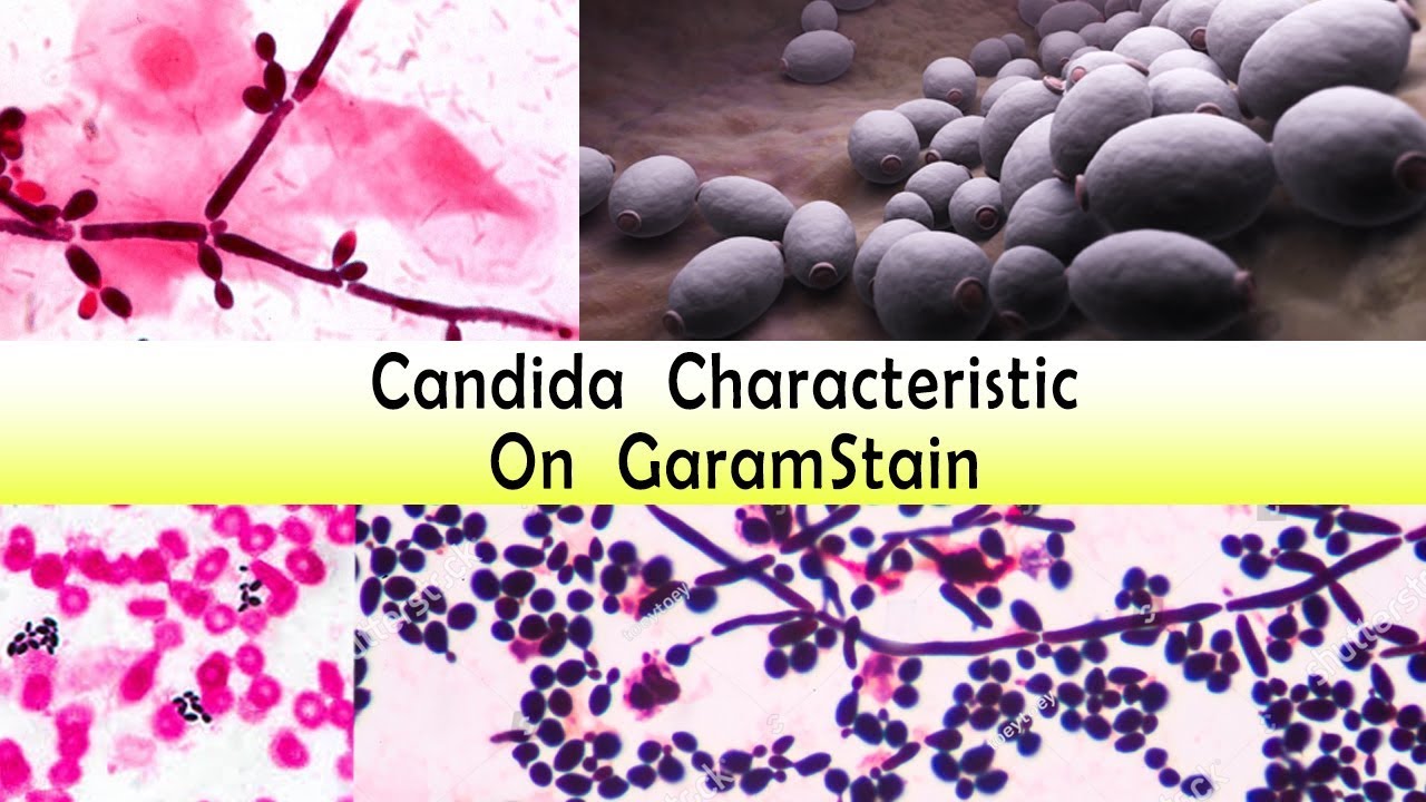 Candida Characteristic  on Gram Stain
