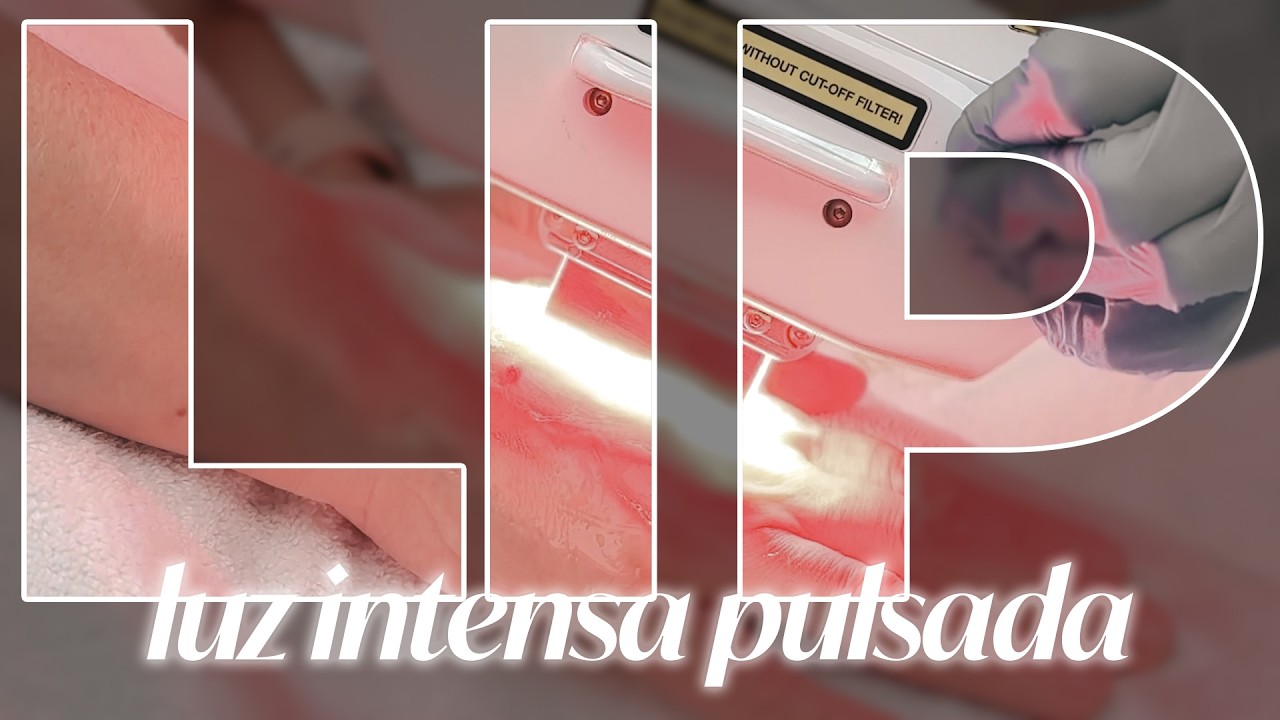 LUZ INTENSA PULSADA: O FIM DAS MANCHAS NA PELE | Clínica Leal Campinas