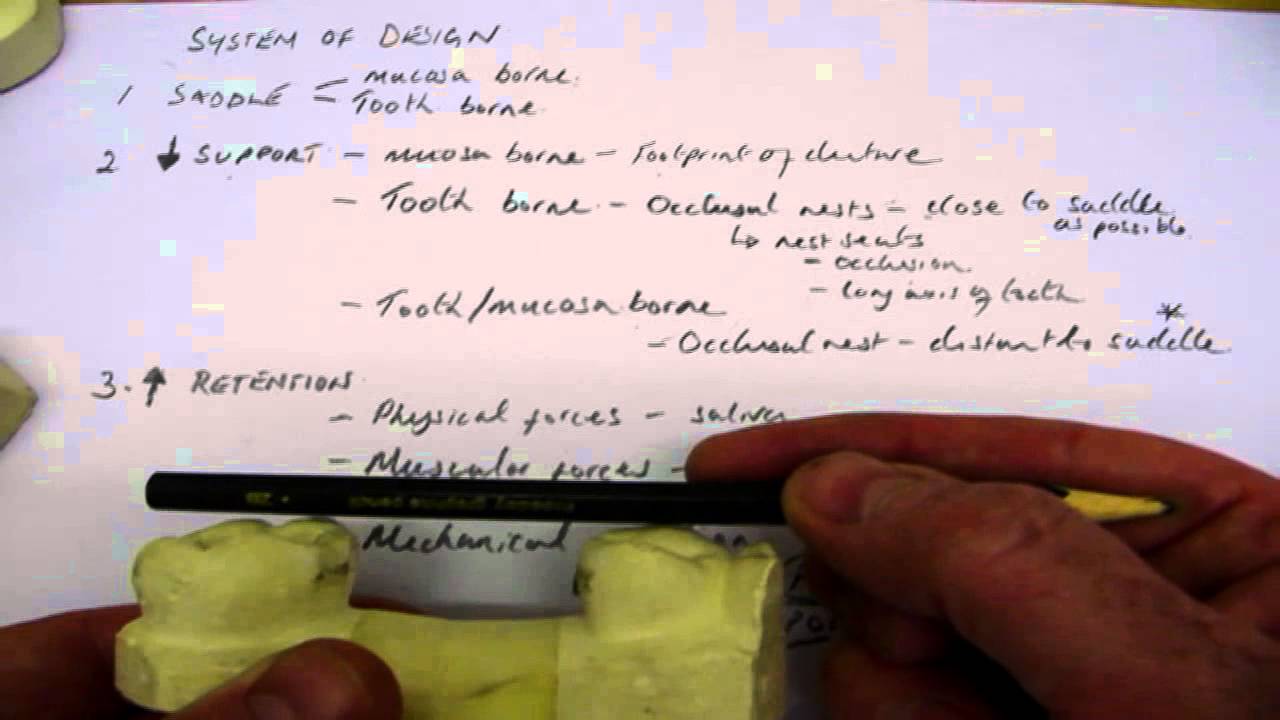 Removable Partial Denture Design Revision (part1)