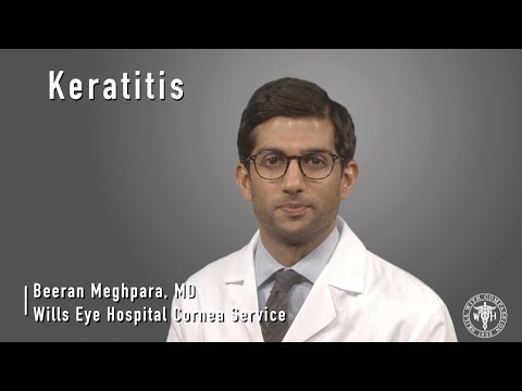 Keratitis - Bacterial and Fungal
