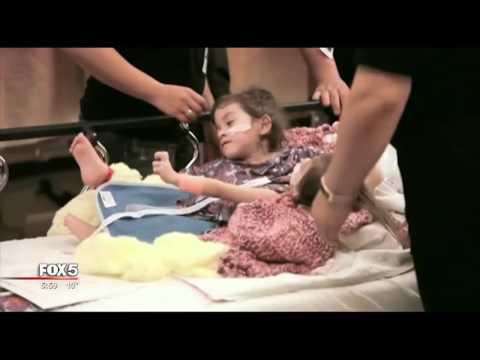 Conjoined twins successfully separated