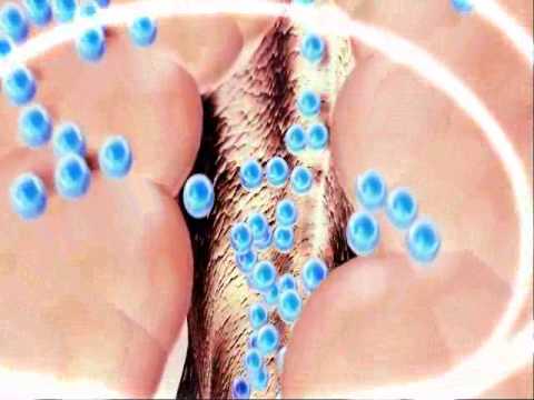 Infusion.flv