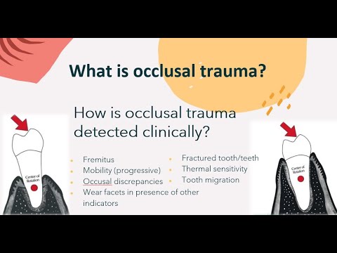 Bedah jurnal trauma oklusal: cara analisis sampai manajemennya