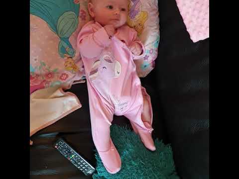 hopes seizures 3 months old,infantile spasms, generalised, focal,tonic, #epilepsy brain damage