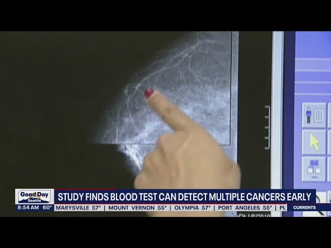 Study finds blood test can detect multiple cancers early | FOX 13 Seattle