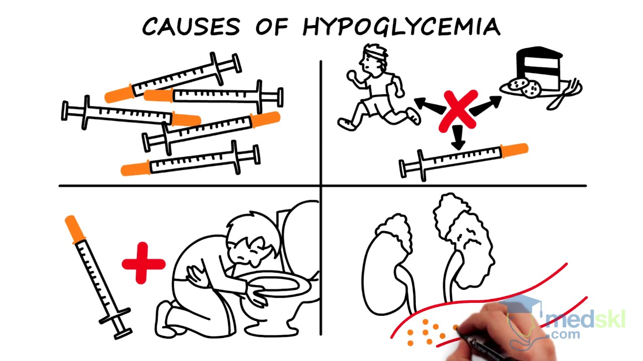Endocrinology – Diabetes Mellitus: By Dawn Dewitt M.D.