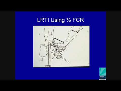 Evaluation & Management of arthritis of the Wrist and Hand: Michael Baskies, MD