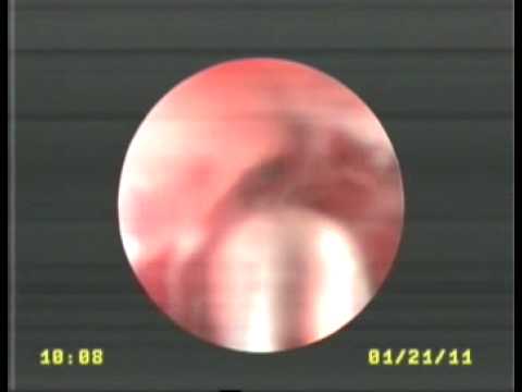 Rhinoscopy on the dog