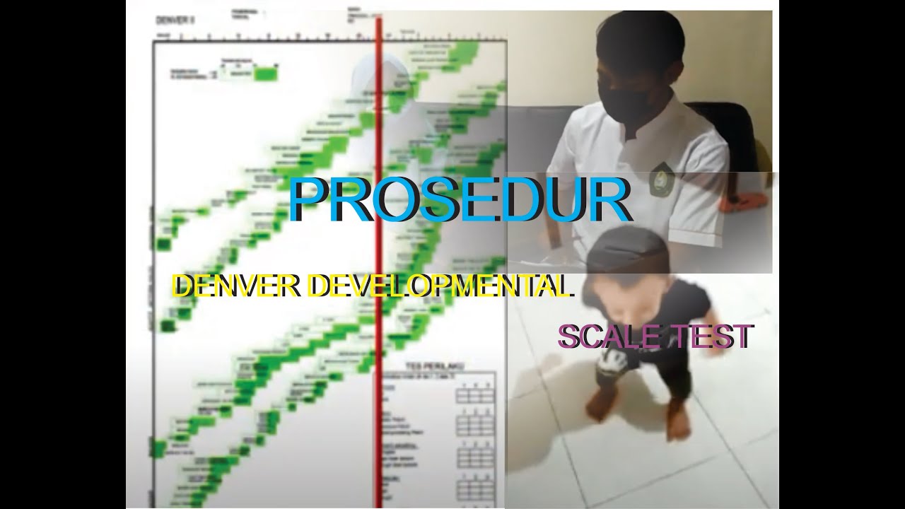 PROSEDUR Denver Development Screening Test:DDST pada anak