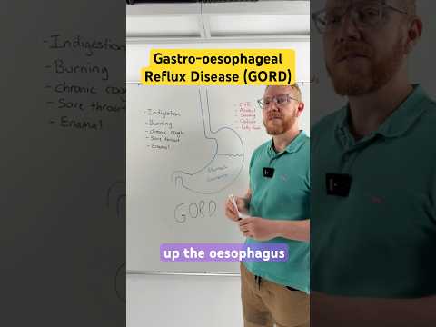 Gastro-oesophageal Reflux Disease (GORD AKA GERD)