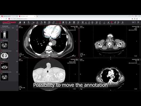 MedDream DICOM Viewer: flexpoly tool
