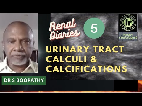 RENAL DIARIES 5 || DR S BOOPATHY || CALCULI AND CALCIFICATIONS - KIDNEY | renal calculi etc