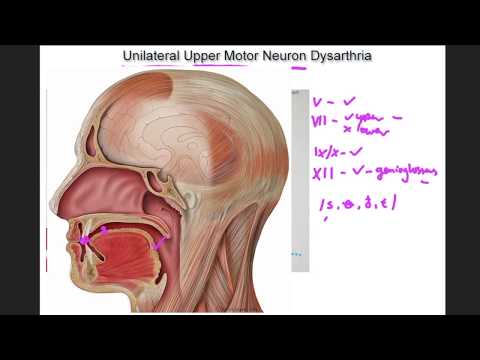 Unilateral Upper Motor Neuron Dysarthria - example and tutorial