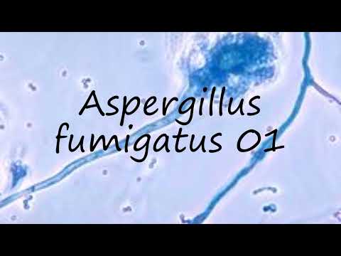 How to pronounce Aspergillus fumigatus 01 in English?